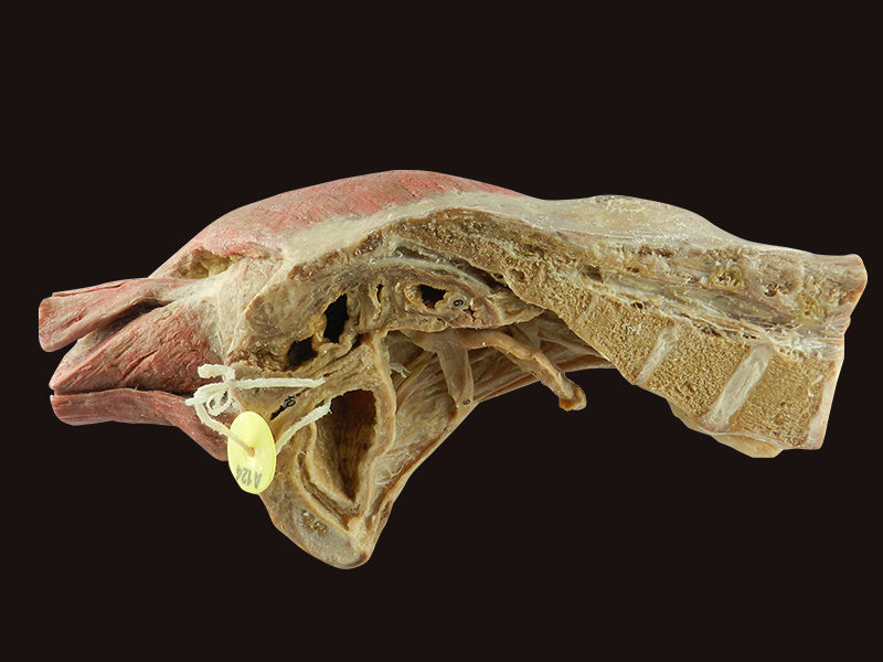 Sagittal Section Female Pelvis