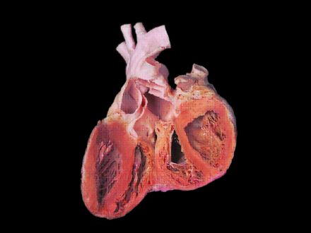 human body parts plastinated specimens