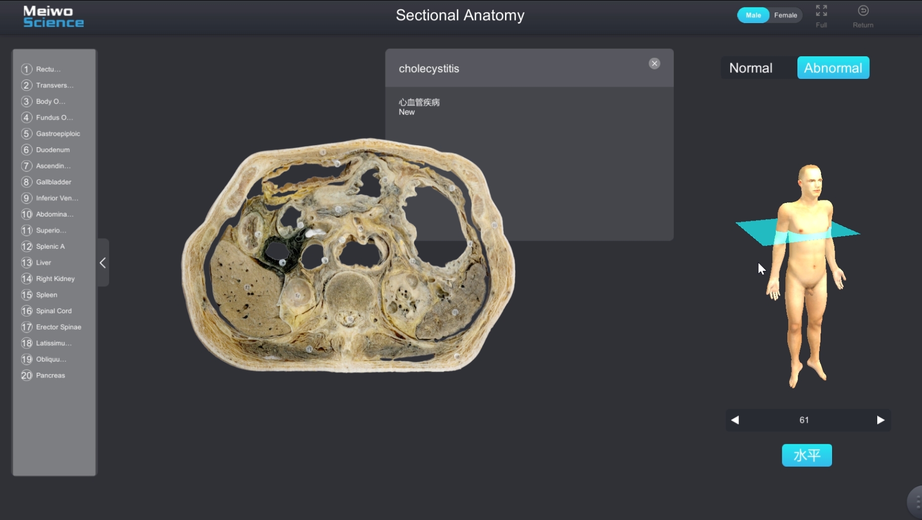 3D Human Anatomy Software